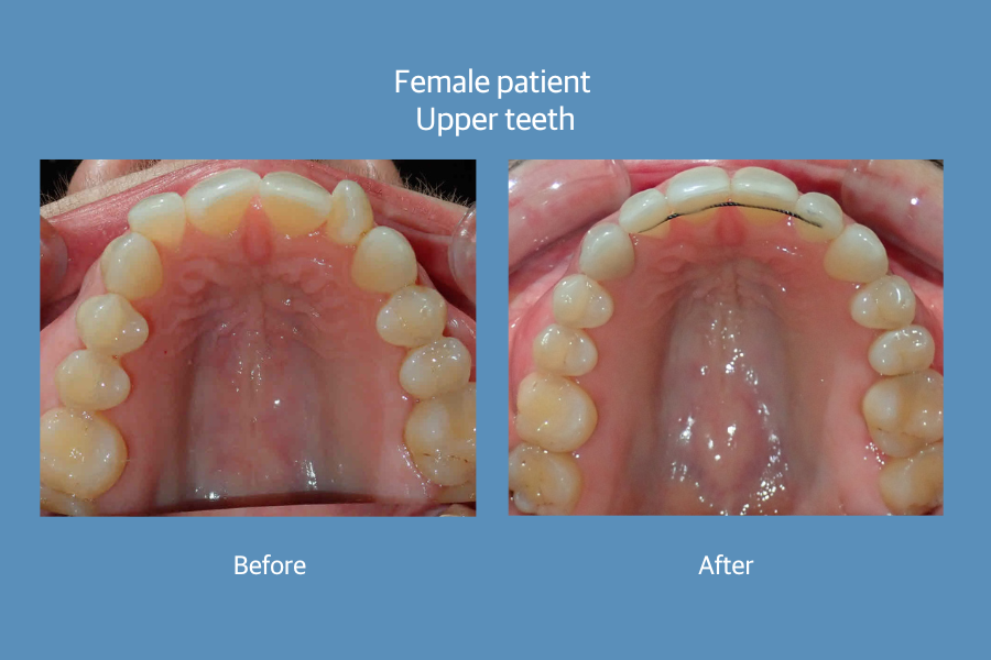 No more expanders, jaw surgery: Dr. Jennifer Buchanan transforms smiles ...